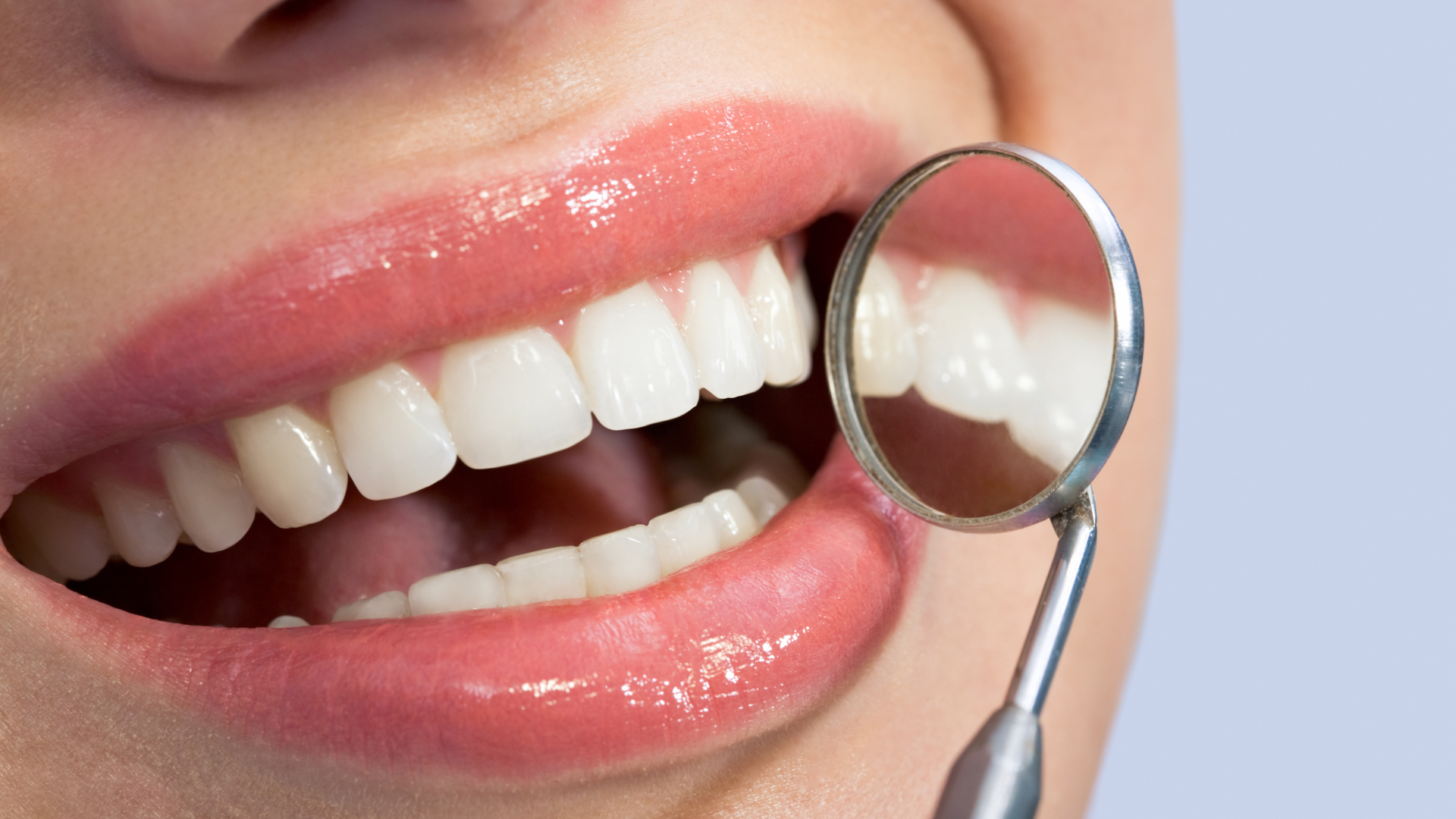 “Turkey Teeth” & What You Should Know Before Travelling Abroad ...